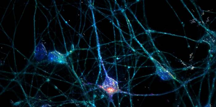 Brain Synapses Galaxy